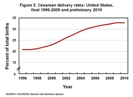 Why is the Cesarean Section Rate So High? | Our Bodies Ourselves