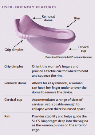 Diaphragm Contraceptive How It Works