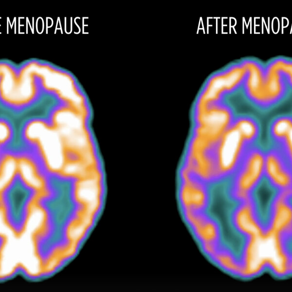 Menopause & Perimenopause | Our Bodies Ourselves