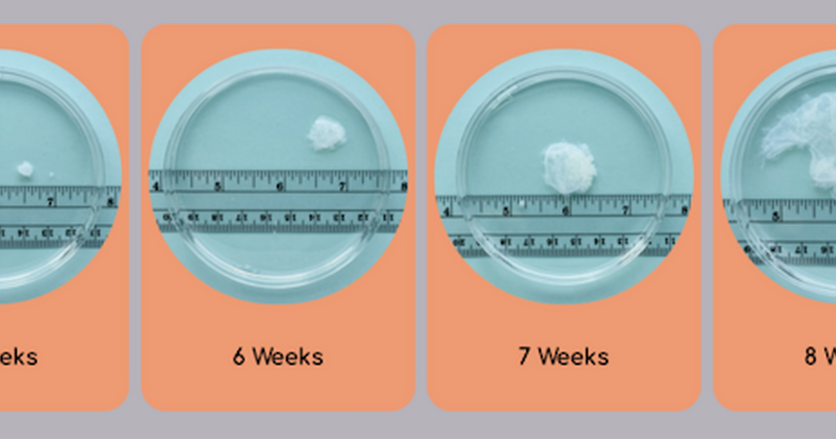 Facts About Pregnancy Tissue | Our Bodies Ourselves
