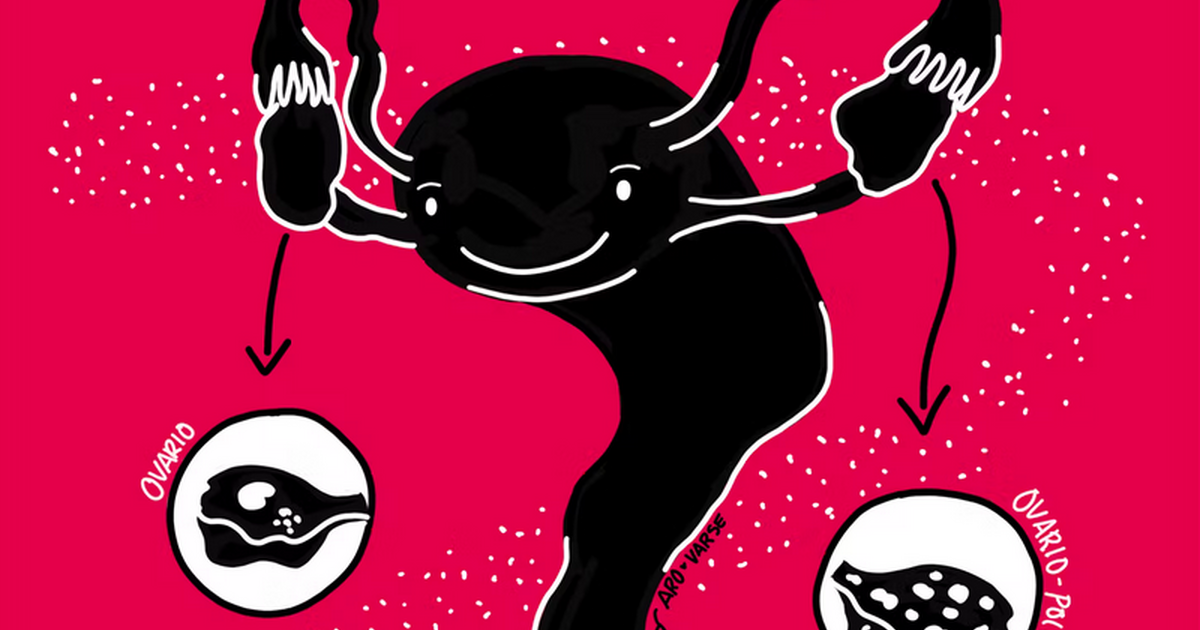 Polycystic Ovary Syndrome (PCOS) | Our Bodies Ourselves